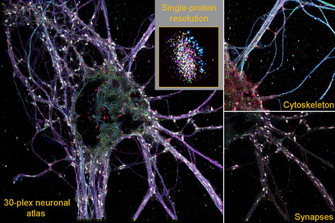 New imaging method enables identification of rare synapses in the brain ...