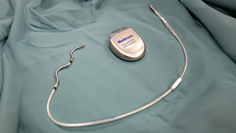 Lifesaver under the skin: defibrillator with sternum electrode ...
