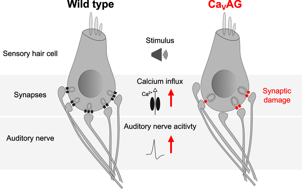 Calcium channel in the ear: How a tiny mistake affects hearing